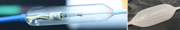 Medical Balloons: Angioplasty to Advanced Therapeutic Applications